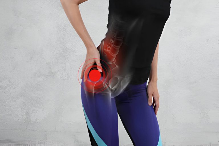 Sciatica vs SI joint pain - How to Tell the Difference?