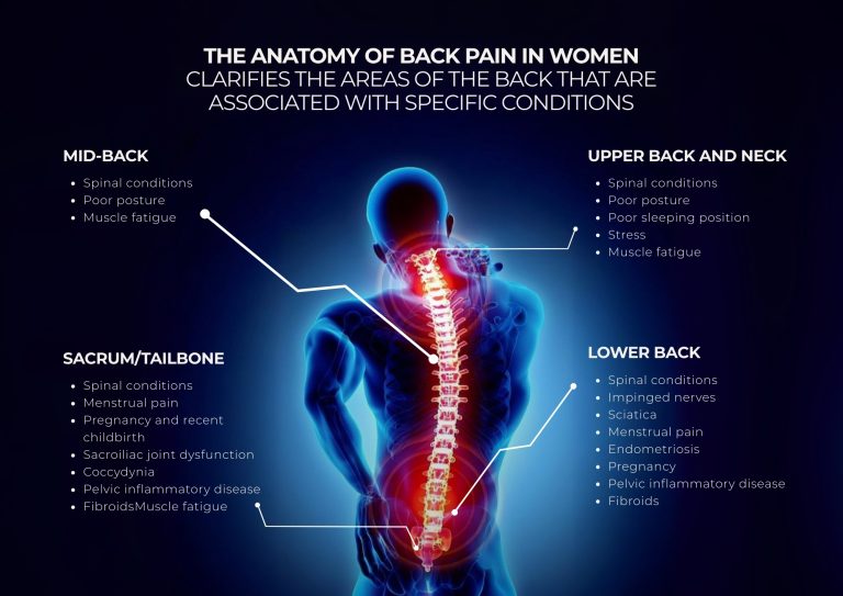 Female Back Pain Chart: Identify Pain, Muscles & Anatomy